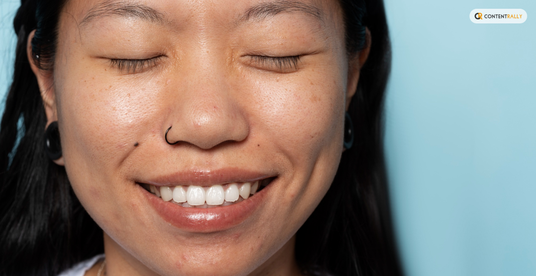 What Is A Beauty Mark?