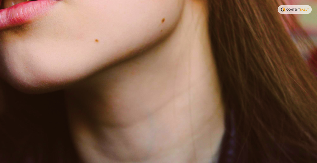 What Is A Beauty Mark?